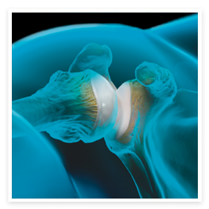 Arthrex Products - Arthrex Lancaster