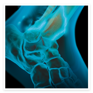 Arthrex Products - Arthrex Lancaster